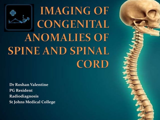Congenital Anomalies Of Spine And Spinal Cord | PPTX | Brain and Nervous System Disorders ...