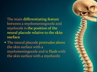 Congenital Anomalies Of Spine And Spinal Cord | PPTX