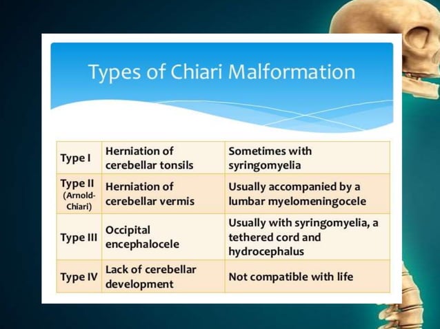 Congenital Anomalies Of Spine And Spinal Cord | PPTX | Brain and Nervous System Disorders ...