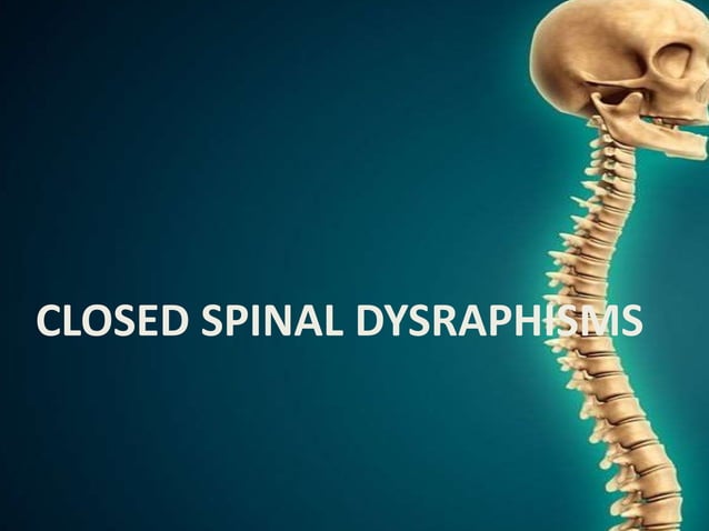 Congenital Anomalies Of Spine And Spinal Cord | PPTX | Brain and Nervous System Disorders ...