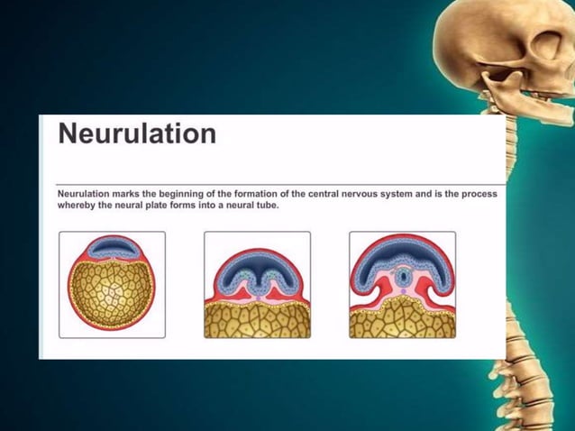 Congenital Anomalies Of Spine And Spinal Cord | PPTX | Brain and Nervous System Disorders ...