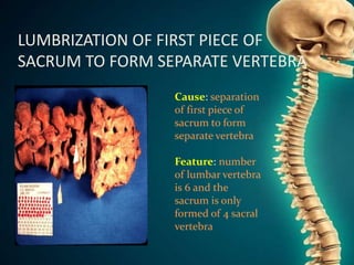 Congenital Defects Of The Spine