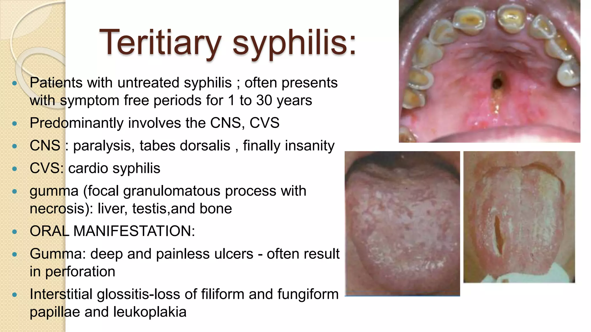 Granulomatous diseases of the head & neck | PPTX