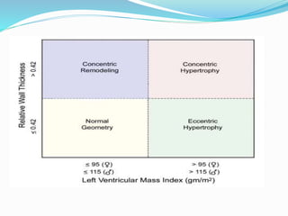 relative wall thickness | PPTX