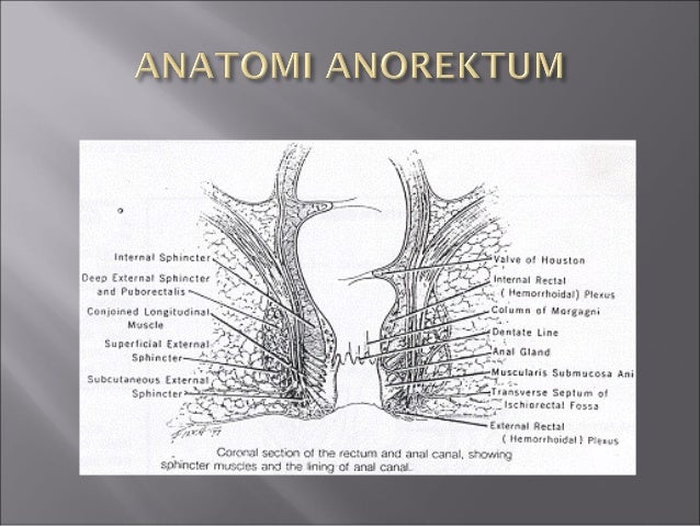 118936363 ppt-hemoroid