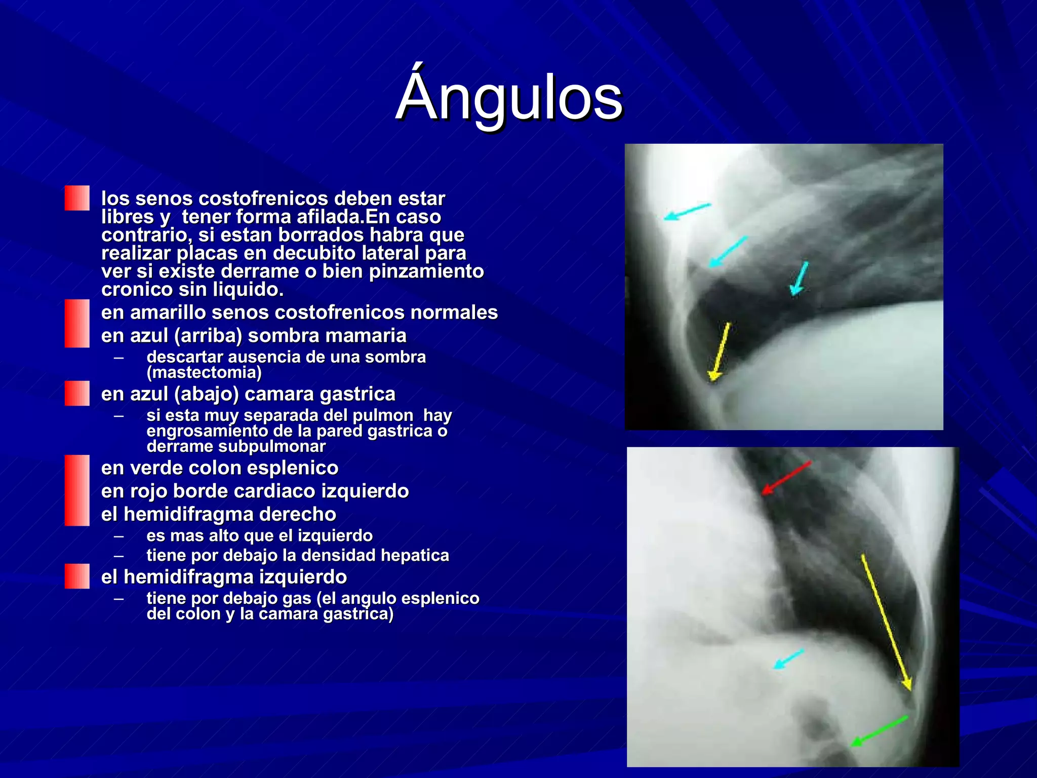 Rx Torax torax normal lo basico
