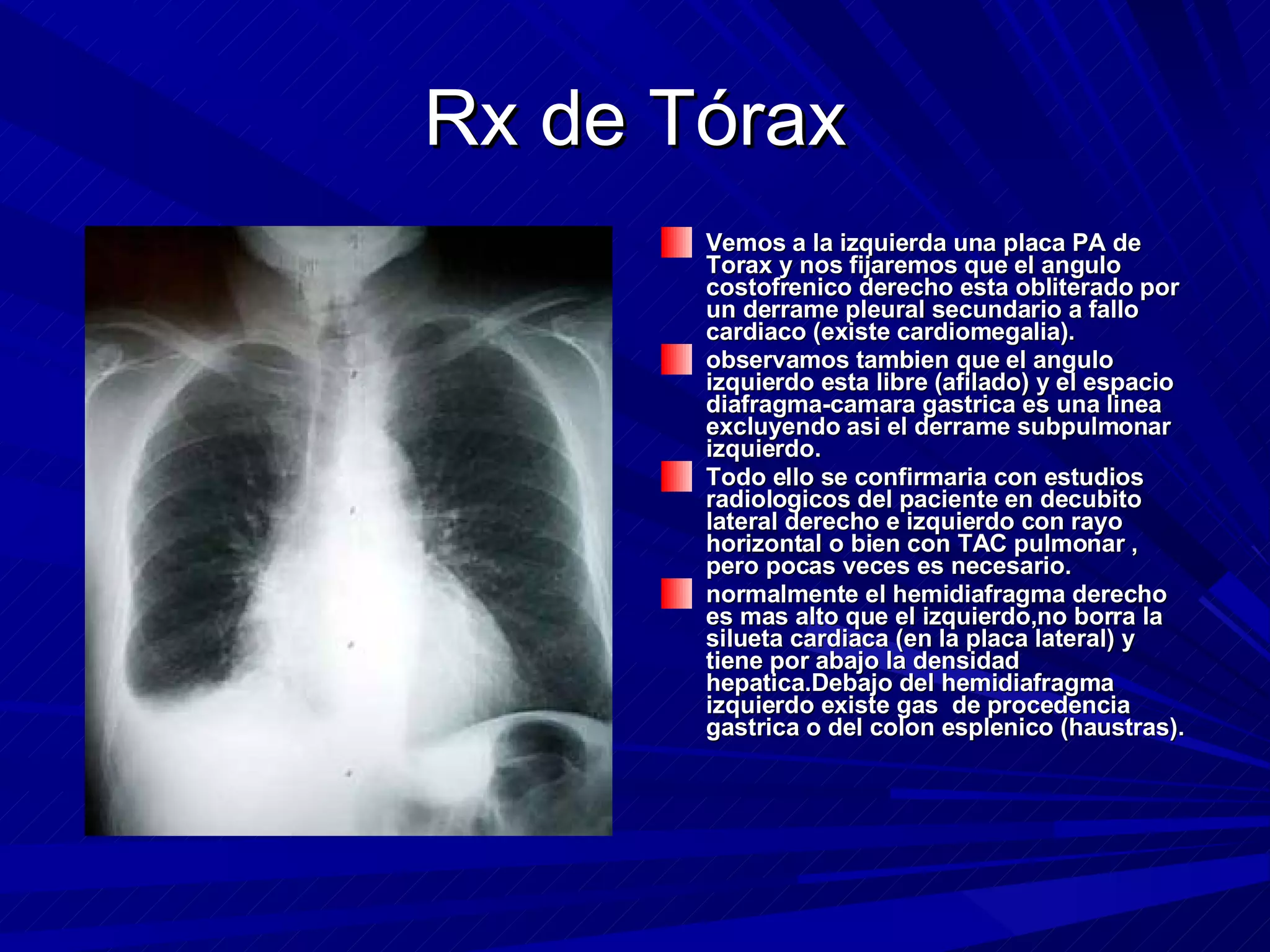 Rx Torax torax normal lo basico