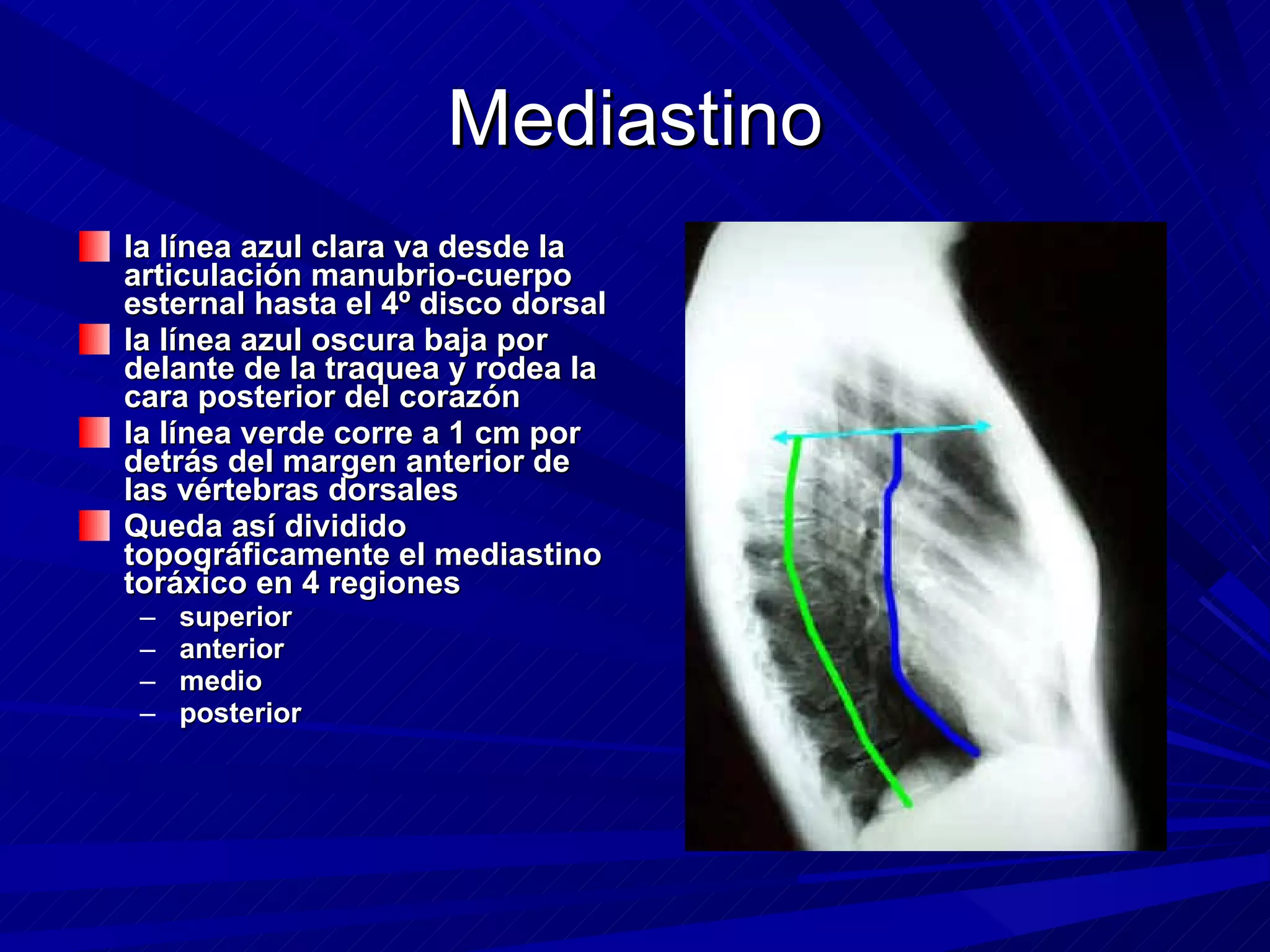 Rx Torax torax normal lo basico