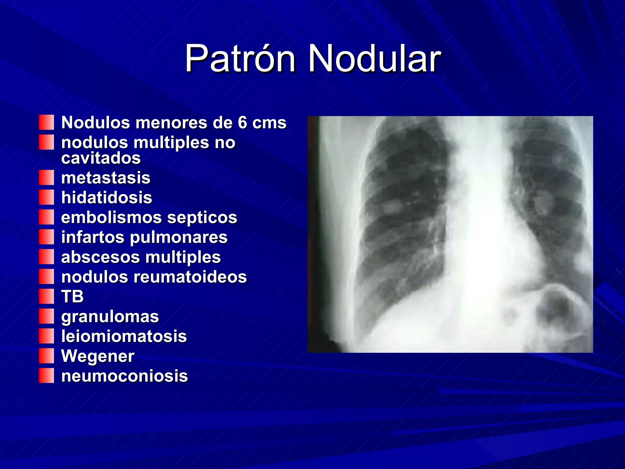 Rx Torax torax normal lo basico