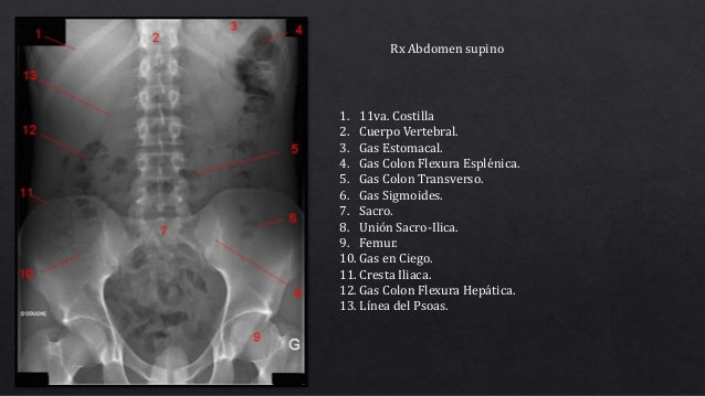 Rx abdomen