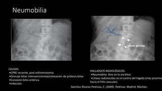 rx abdomen.pptx