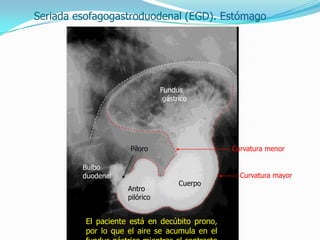Rx abdomen a r | PPSX