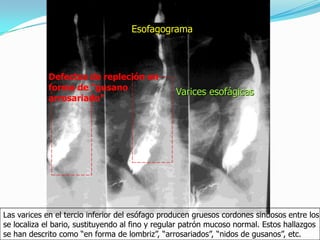 Rx abdomen a r | PPSX