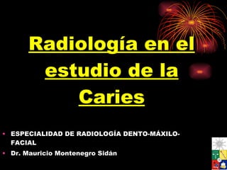 Rx Caries | PPT