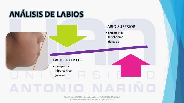 CASO CLÍNICO DE ODONTOPEDIATRIA BIBI MOLINA