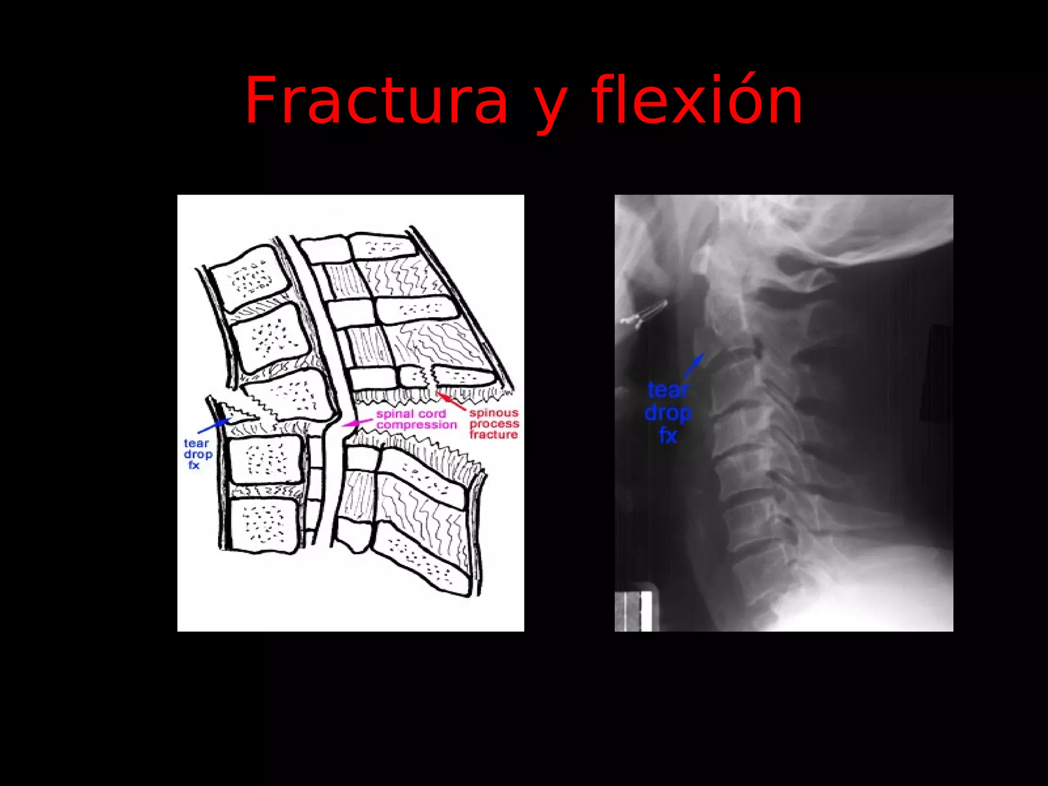 Rx.Columna Cervical