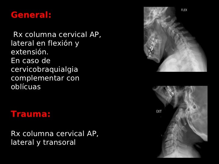 Rx.Columna Cervical
