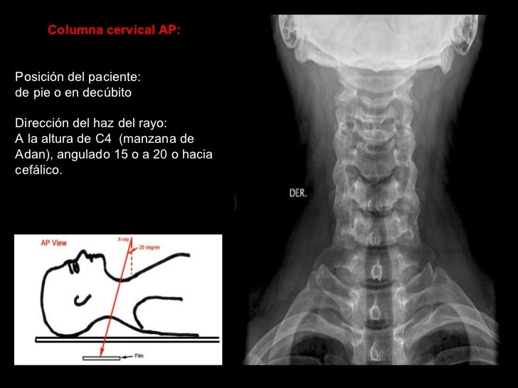 Rx.Columna Cervical