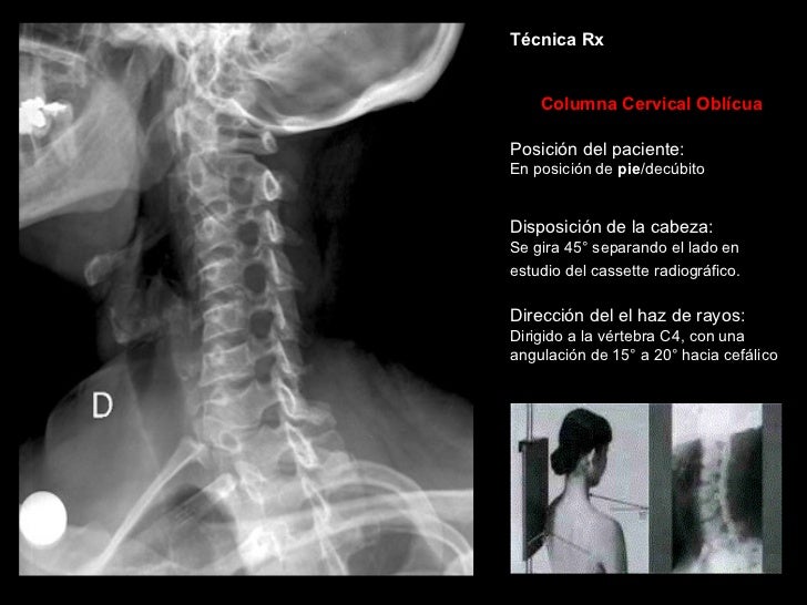 Rx.Columna Cervical