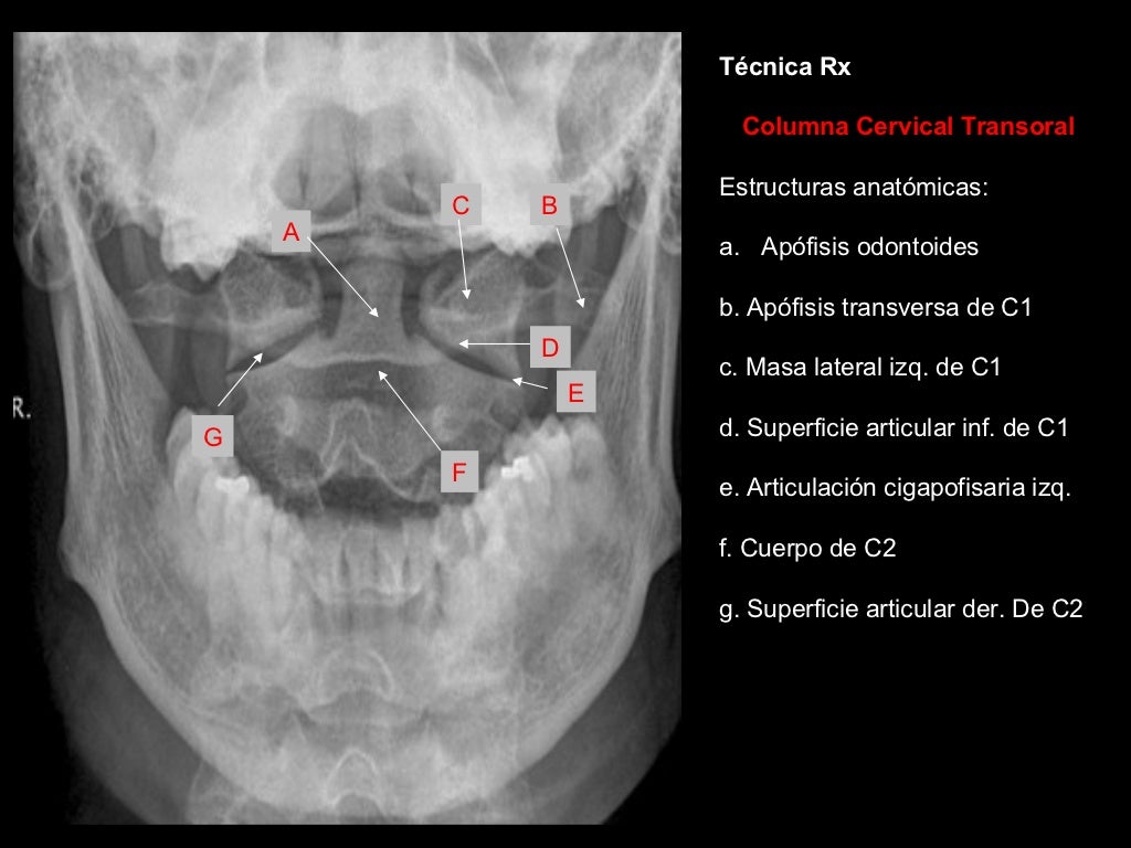 Rx.Columna Cervical