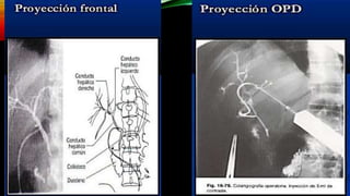 Rx con contraste bilis | PPTX