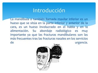 Rx de mandibula | PPTX