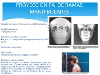 Rx de mandibula | PPTX