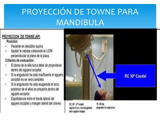 Rx de mandibula | PPTX