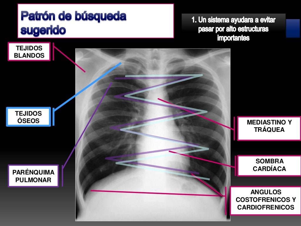 Radiografia Do Tórax Em Pa - RETOEDU
