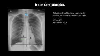 RX de torax.pptx