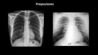 RX de torax.pptx