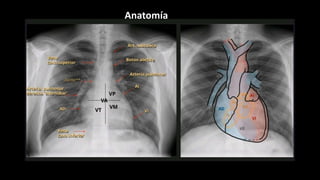 RX de torax.pptx