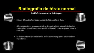 Radiografiax de torax Generalidades.pptx