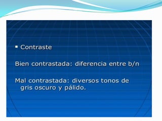 Radiologia de torax normal. lectura de una Rx | PDF