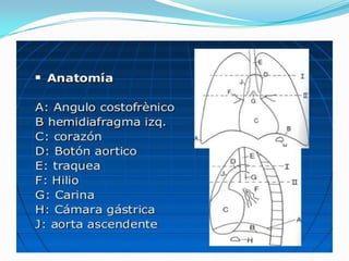 Radiologia de torax normal. lectura de una Rx | PDF