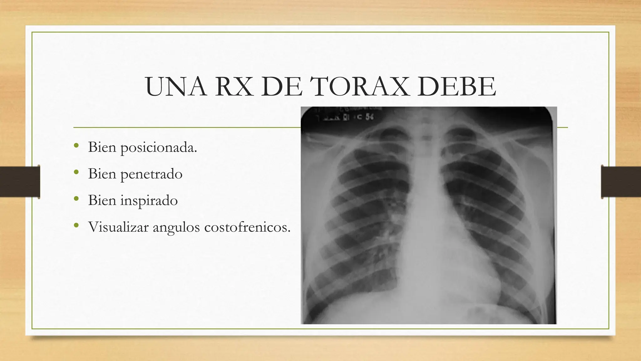 RX DE TORAX NORMAL-HISTORIA Y GENERALIDADES.pdf