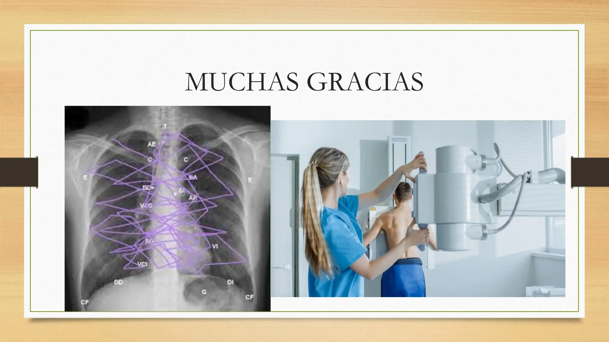 RX DE TORAX NORMAL-HISTORIA Y GENERALIDADES.pdf