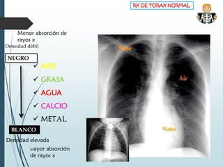 RX DE TÓRAX.pdf interpretación de radiografía de tórax | PDF