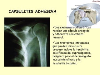 Rx Hombro | PPT