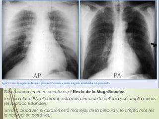 Radiografia normal de torax | PPT