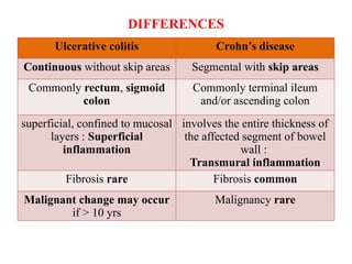 Rx of irritable bowel disease (IBD )Department of pharmacology | PPTX