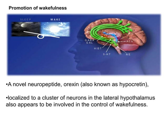 Pharmacotherapy of insomnia | PPTX | Sleep Disorders | Diseases and ...