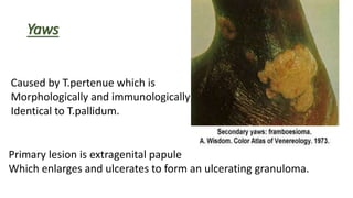 Treatment of syphilis | PPT