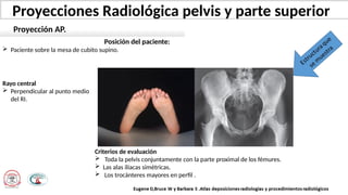 RX pelvis y cadera para presentar ya listo | PPTX