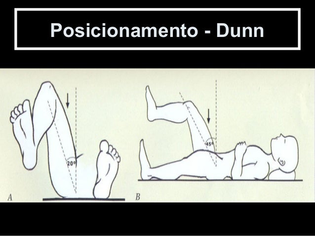 Avaliação Radiologica do Quadril Doloroso