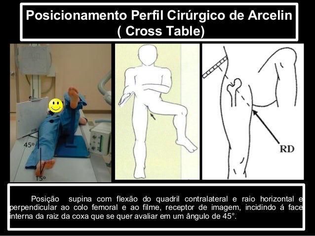 Avaliação Radiologica do Quadril Doloroso