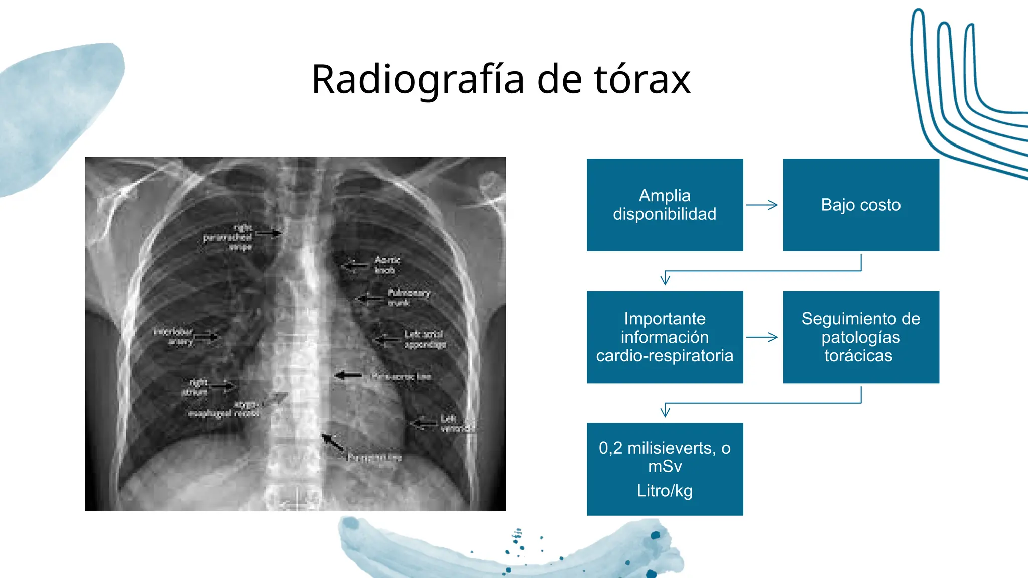 RX TORAX para interpretación de radiografía.pptx