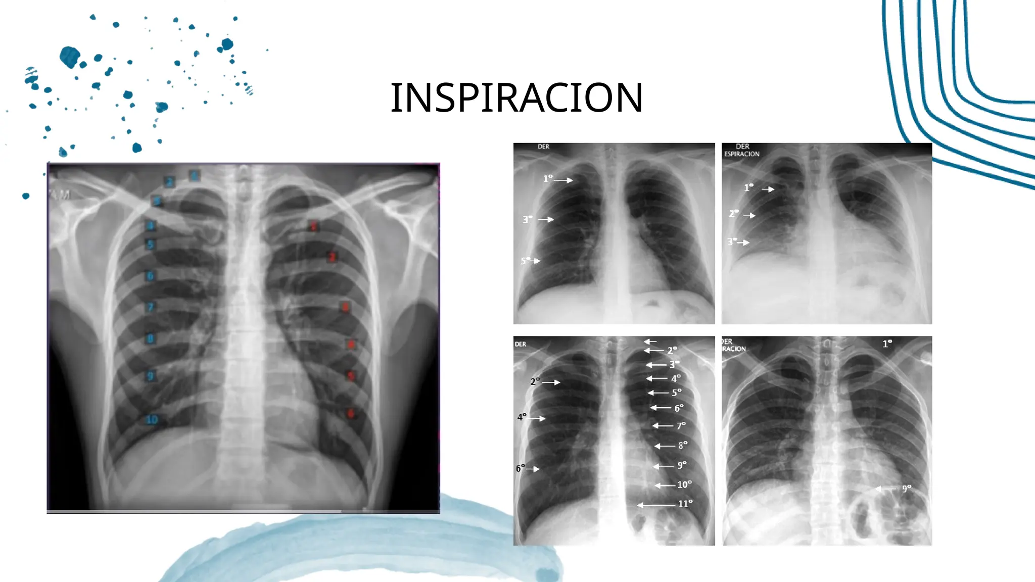 RX TORAX para interpretación de radiografía.pptx