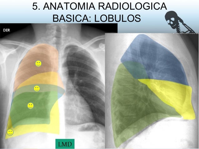 TELE TORAX: Lectura basica radiografia de torax