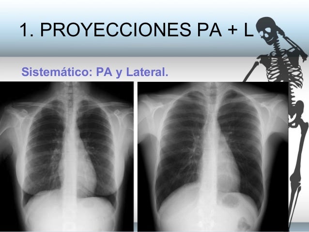 TELE TORAX: Lectura basica radiografia de torax